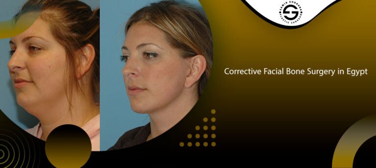 Corrective Facial Bone Surgery in Egypt - DR. SAMIR GHORABA